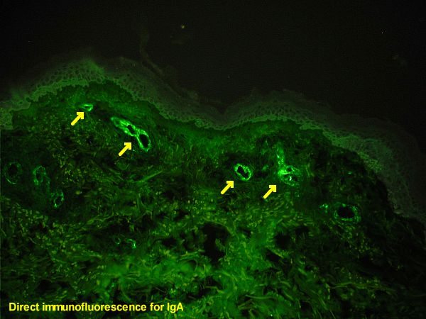 Immunofluorescence | Wiki | Everipedia