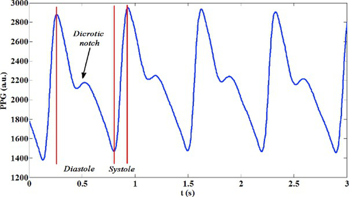 PPG Signal Analysis | Wiki | Everipedia